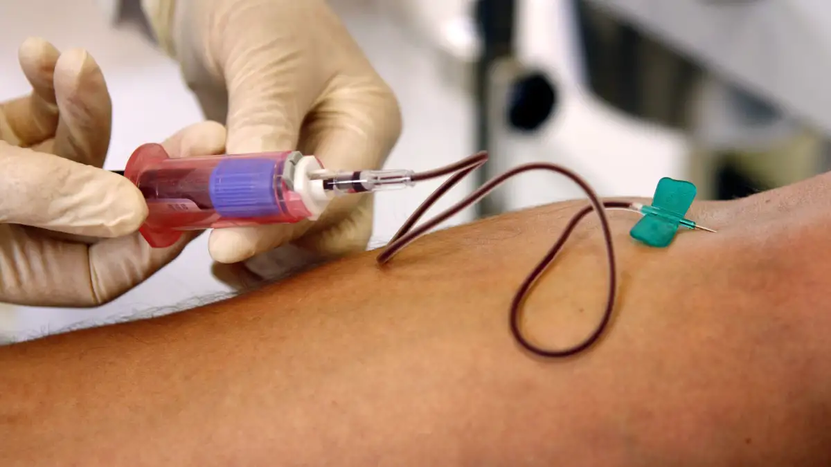 Blutbilder: Was das Blut über unsere Gesundheit verrät